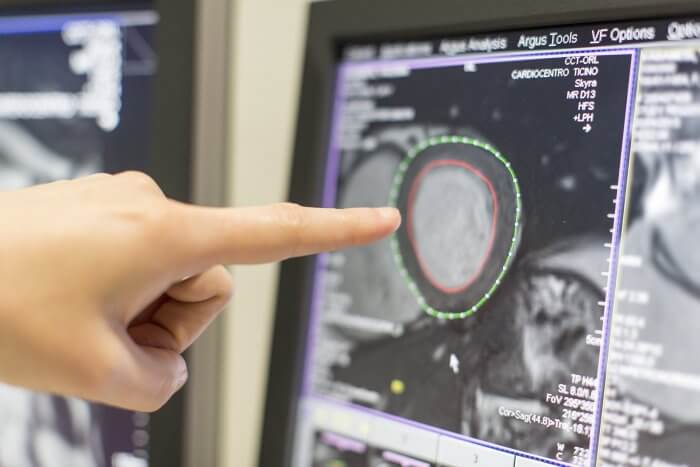 3D echocardiography course : Istituto Cardiocentro Ticino