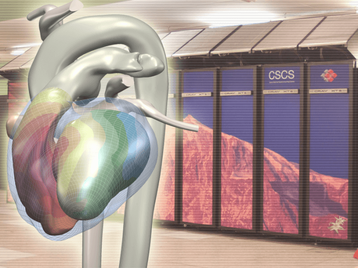 A supercomputer to understand the failing heart : Istituto Cardiocentro ...