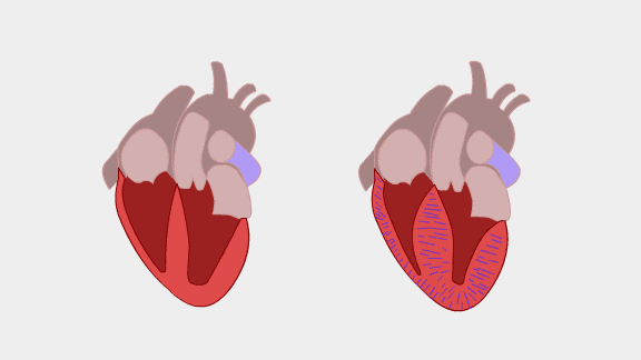 Amyloidosis outpatient clinic : Istituto Cardiocentro Ticino